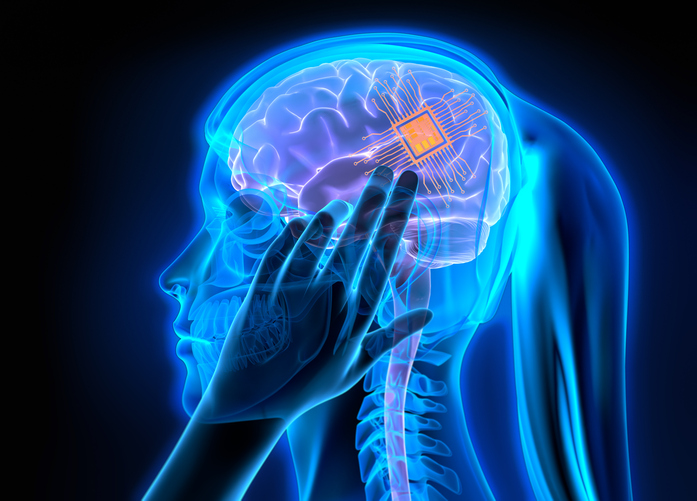 A Neuralink Quer Implantar Chips Em Cérebros De Voluntários Portal Oficial Da